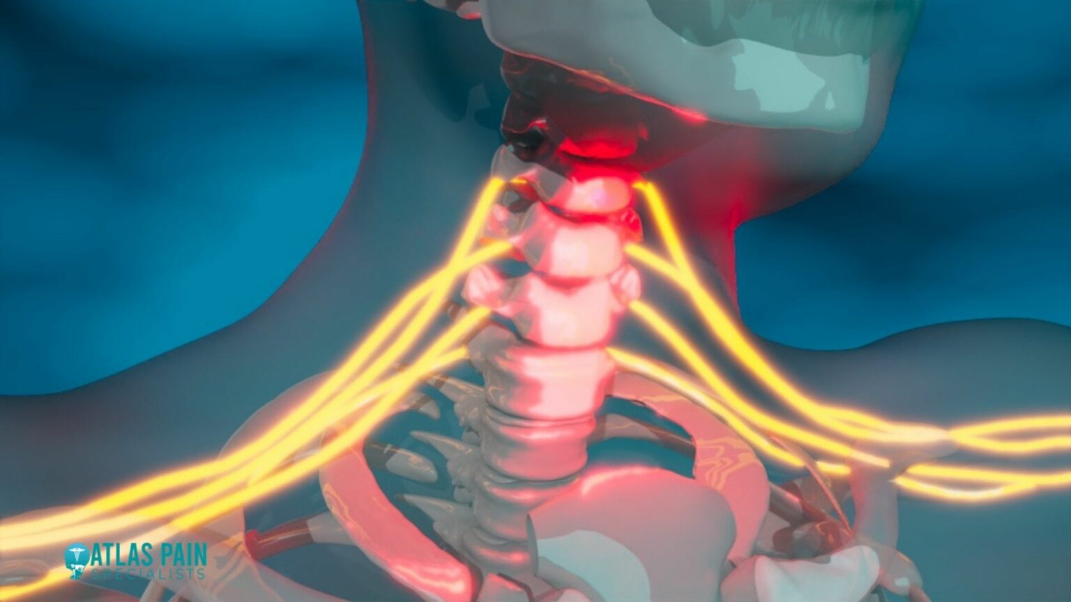 The Different Types of Neck Pain and Their Causes