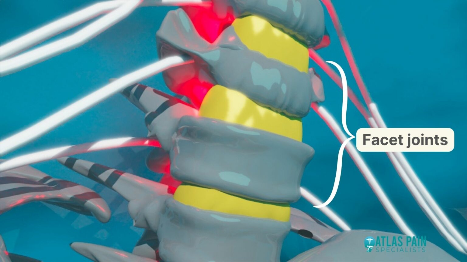 The Different Types of Neck Pain and Their Causes