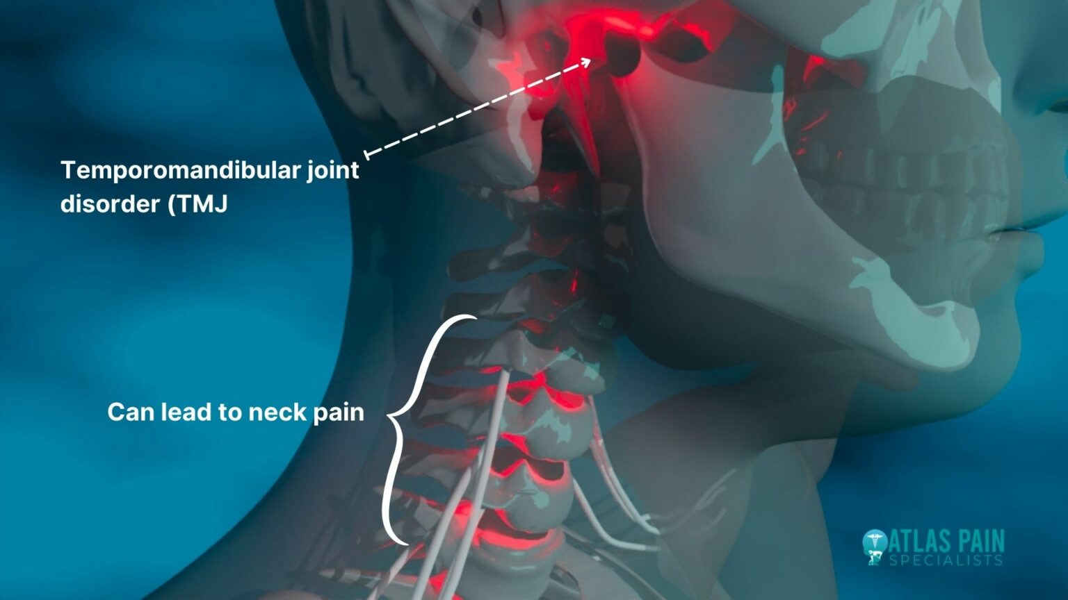 The Different Types of Neck Pain and Their Causes