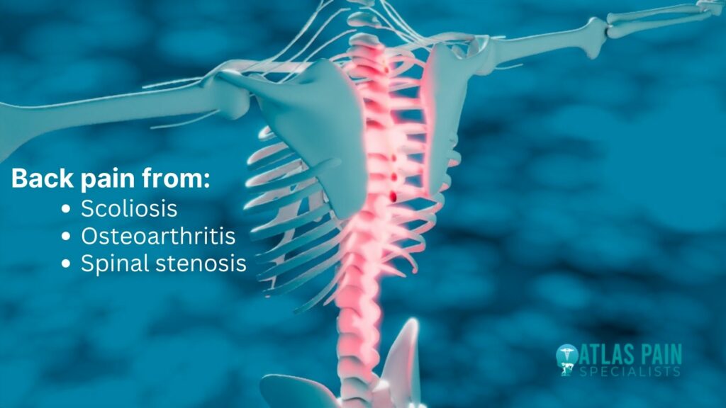 How a Sedentary Lifestyle Is Fueling Your Back Pain