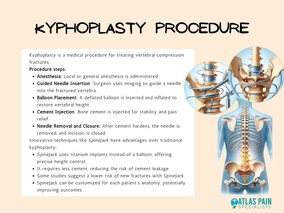 Kyphoplasty for Spinal Compression Fractures: What to Expect - Atlas ...