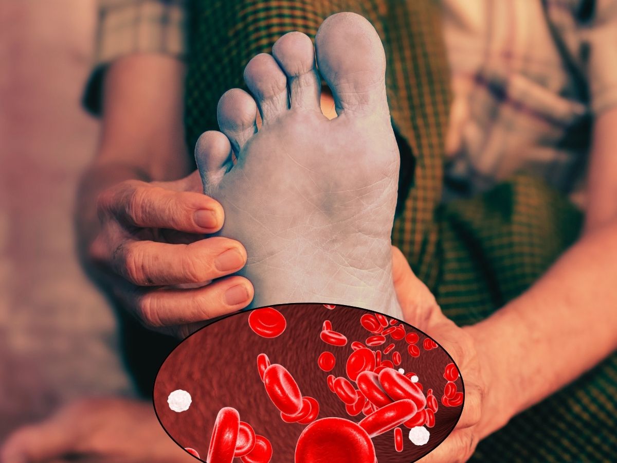 Understanding the Causes and Symptoms of Leg Cramps - Atlas Pain ...