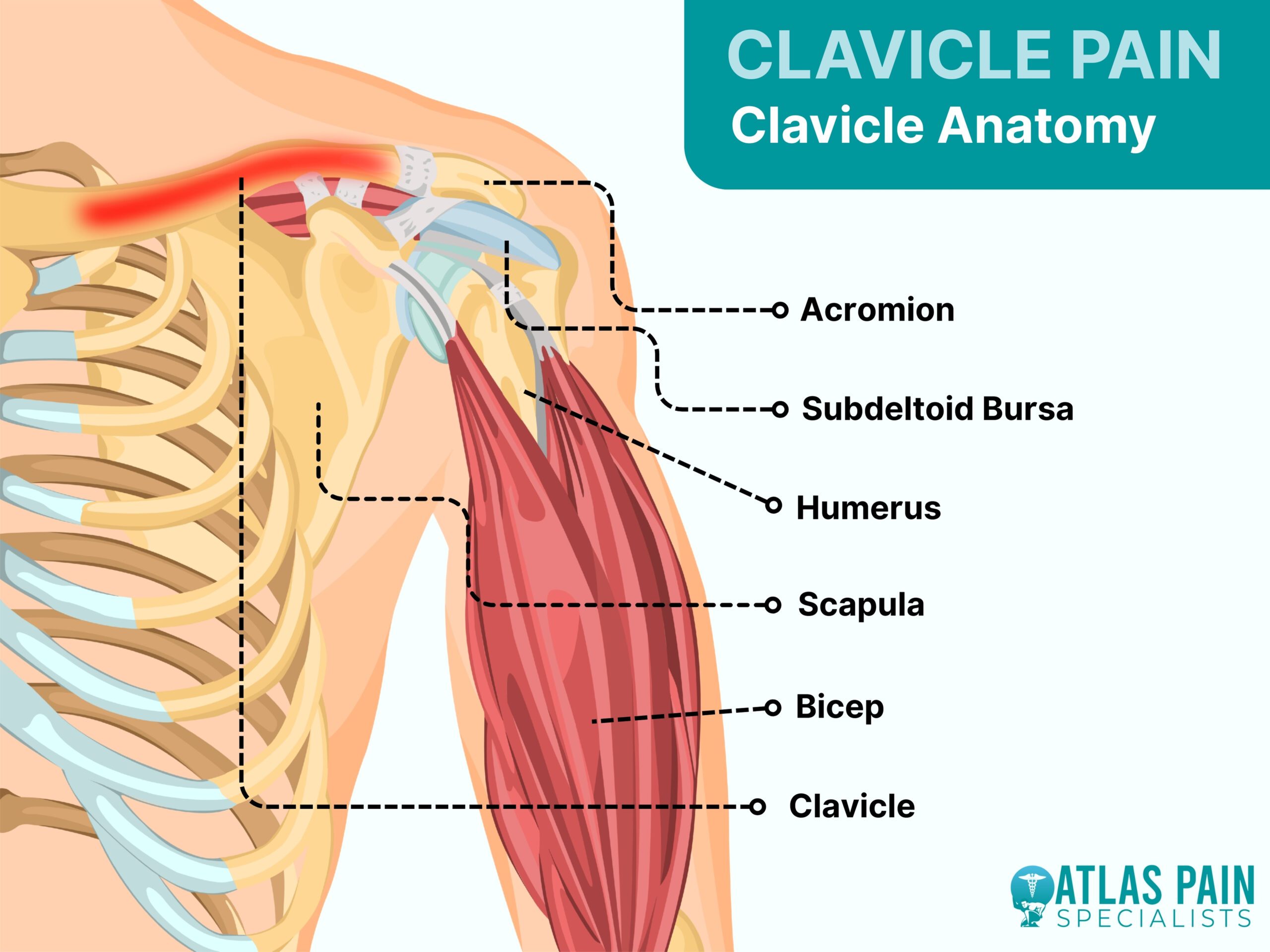 What Causes Clavicle Pain - Atlas Pain Specialists
