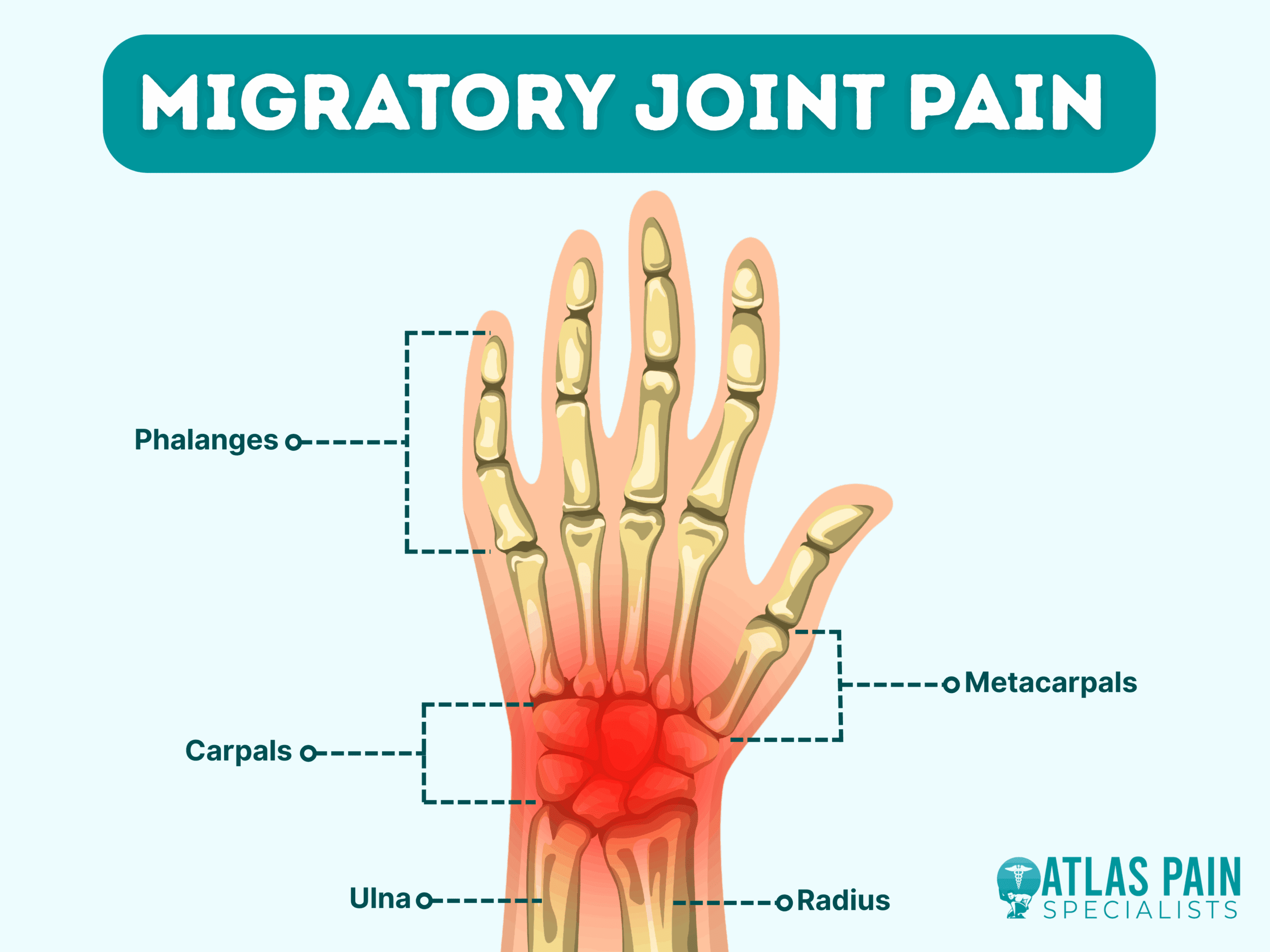 Migratory Joint Pain Explained: Causes, Diagnosis, and Treatment ...